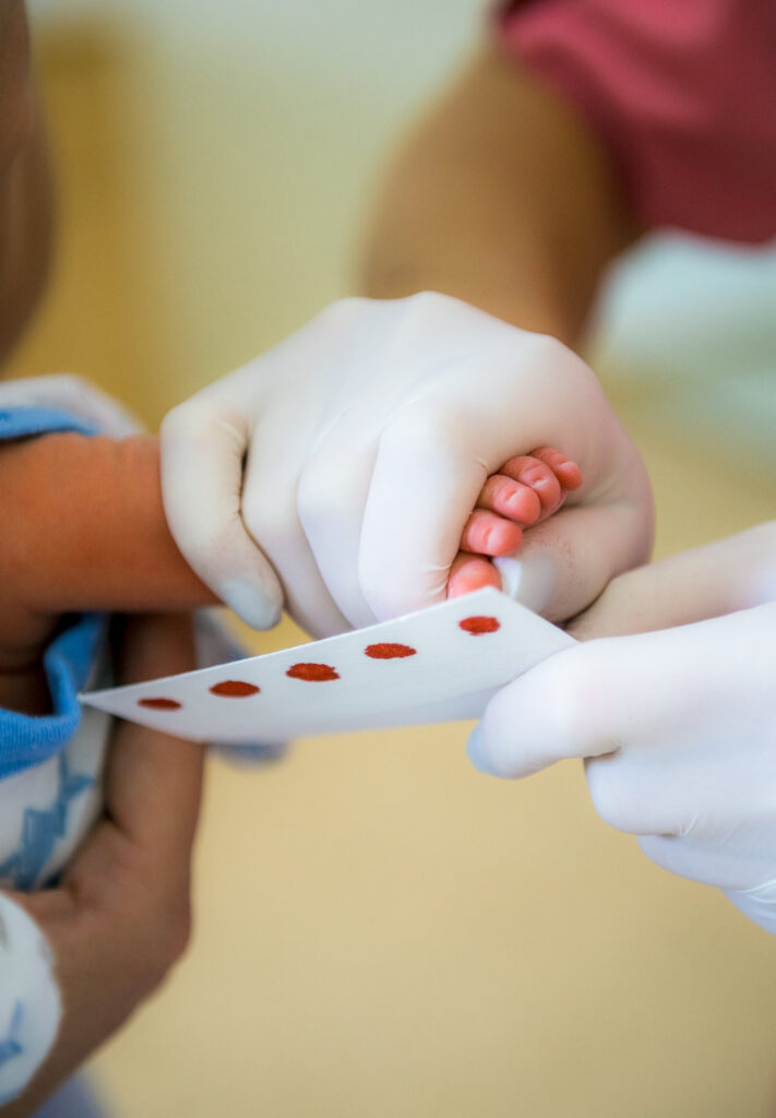 Lab Insights - Should newborn screening include chromosome 15q disorders?