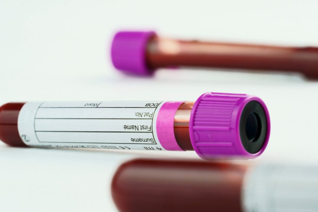 HbA1c implementation in clinical labs by Prof Aw Tar Choon